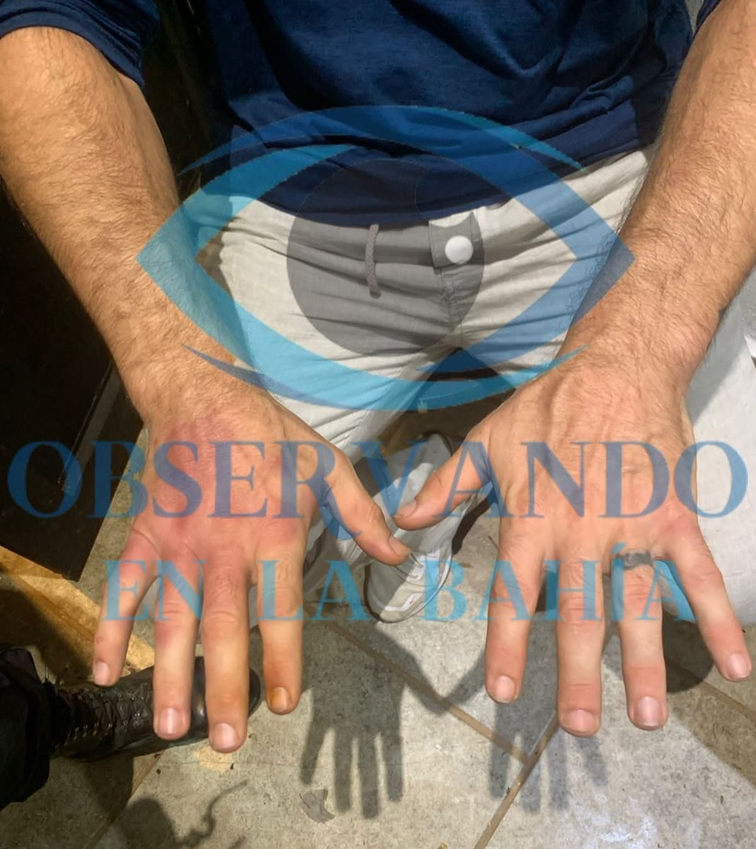 Phil Baroni Arrested In Mexico, Charged With Murder Of Girlfriend