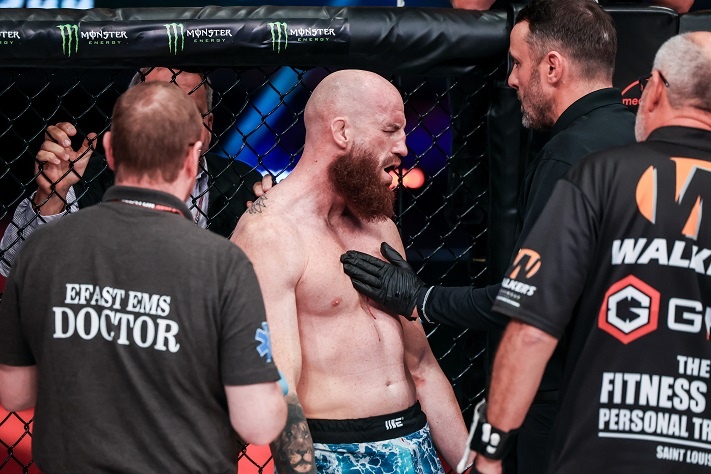 Peter Queally Thought He'd Lost An Eye Following Bellator 299 Poke